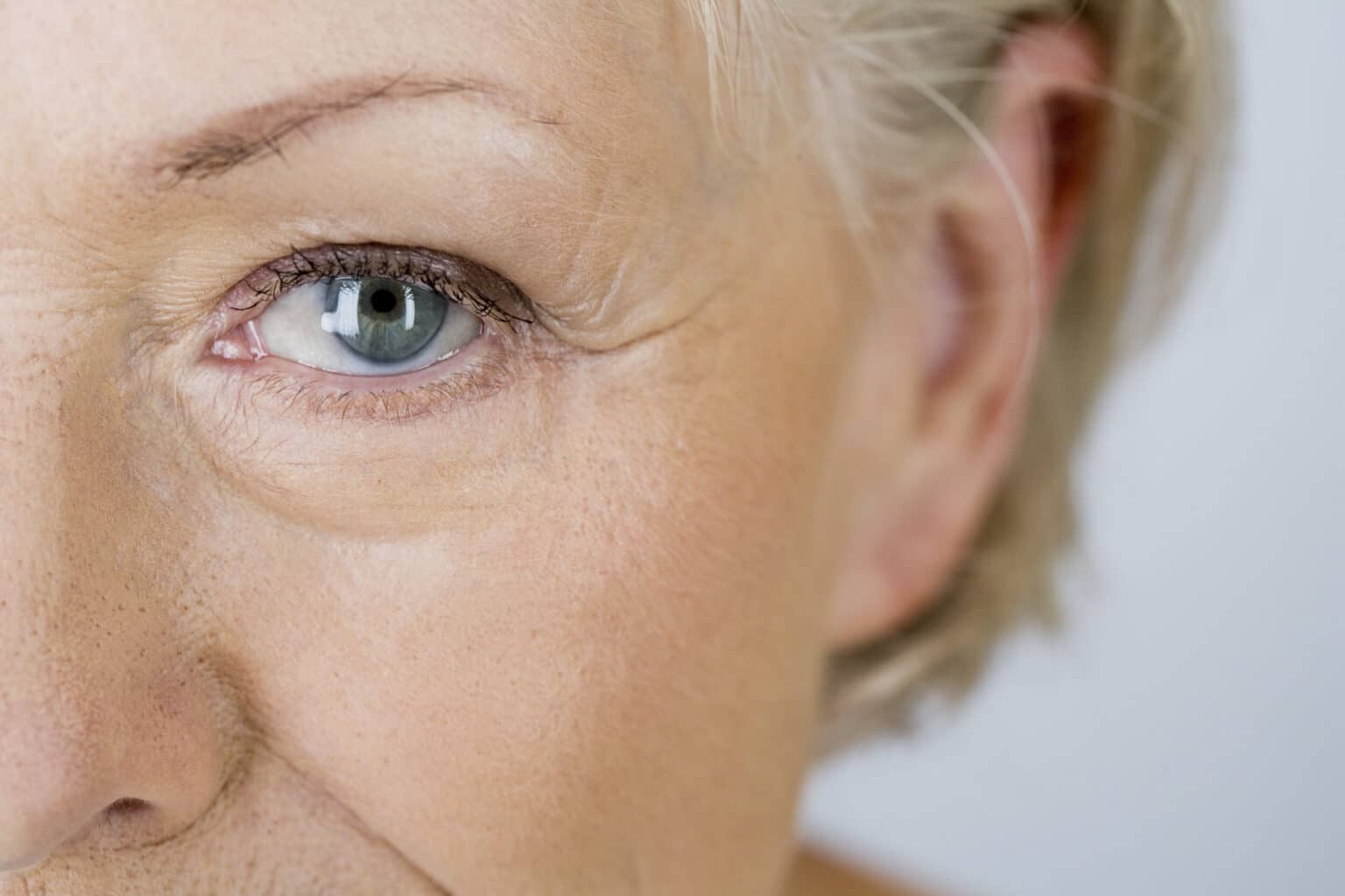 Sagging Eyelids and Eye bags - EC Clinic London