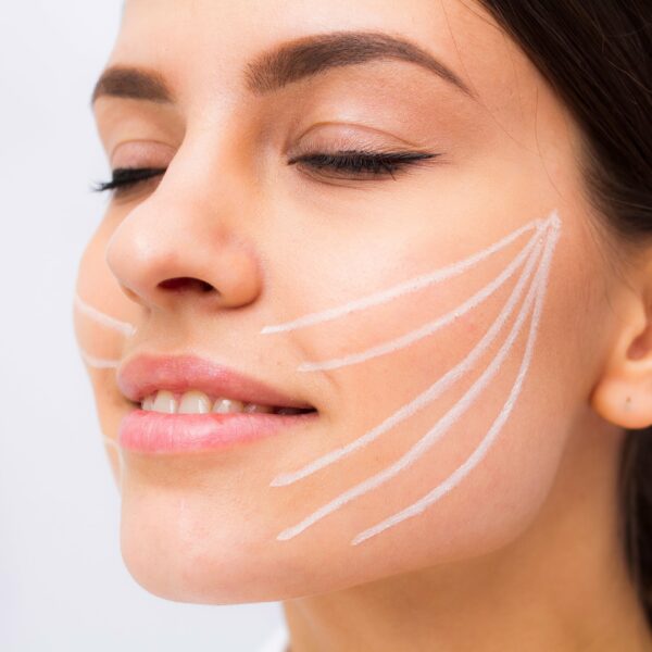 Soft Thread Lift - EC Aesthetic Clinic London